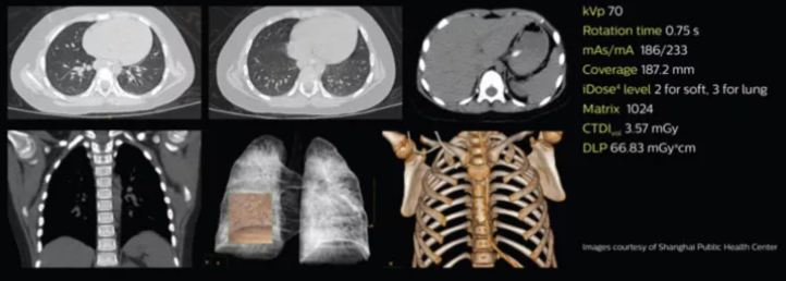 TAC - Tomografia Assiale Computerizzata - Chiama il 06-2070889
